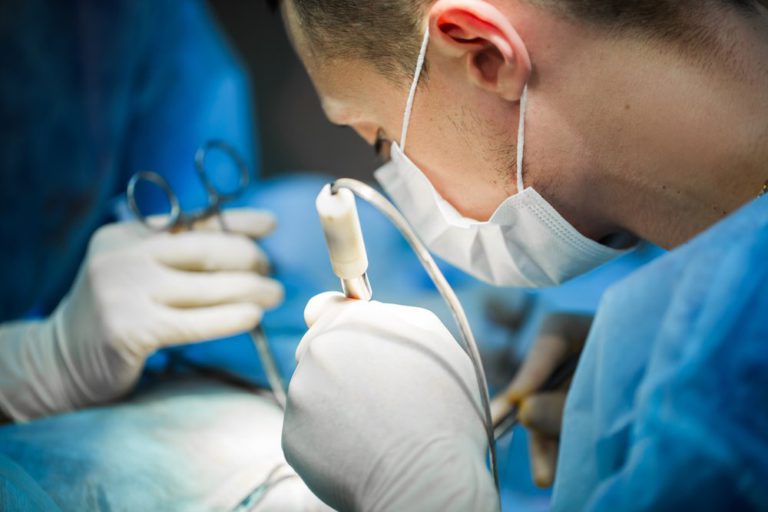 Toe Shortening Surgery