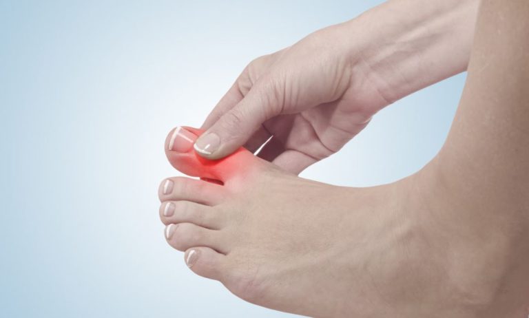 Stiff Toe After Bunion Surgery