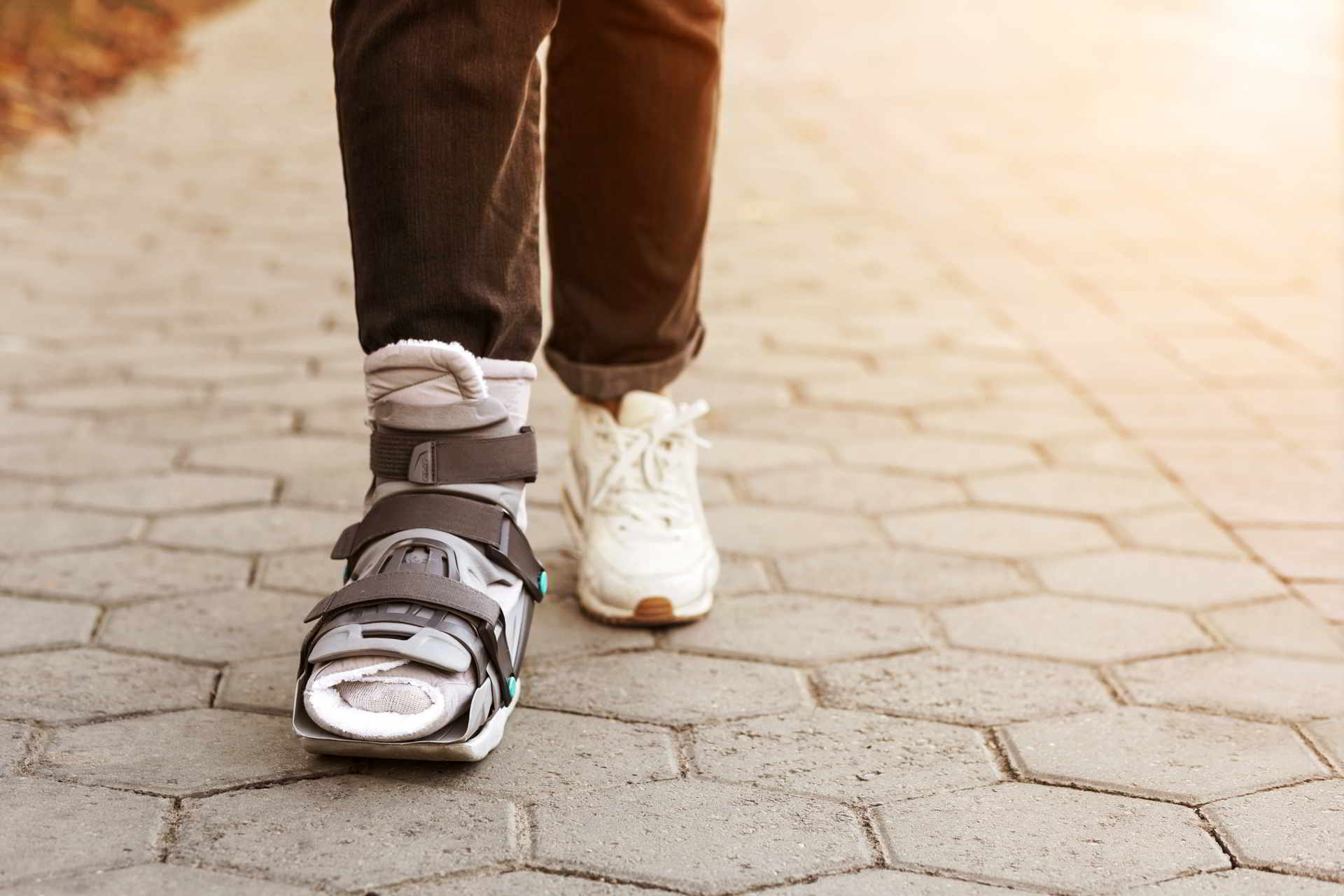 Bunion Revision Surgery Miami - Dr. Ray Lopez DPM