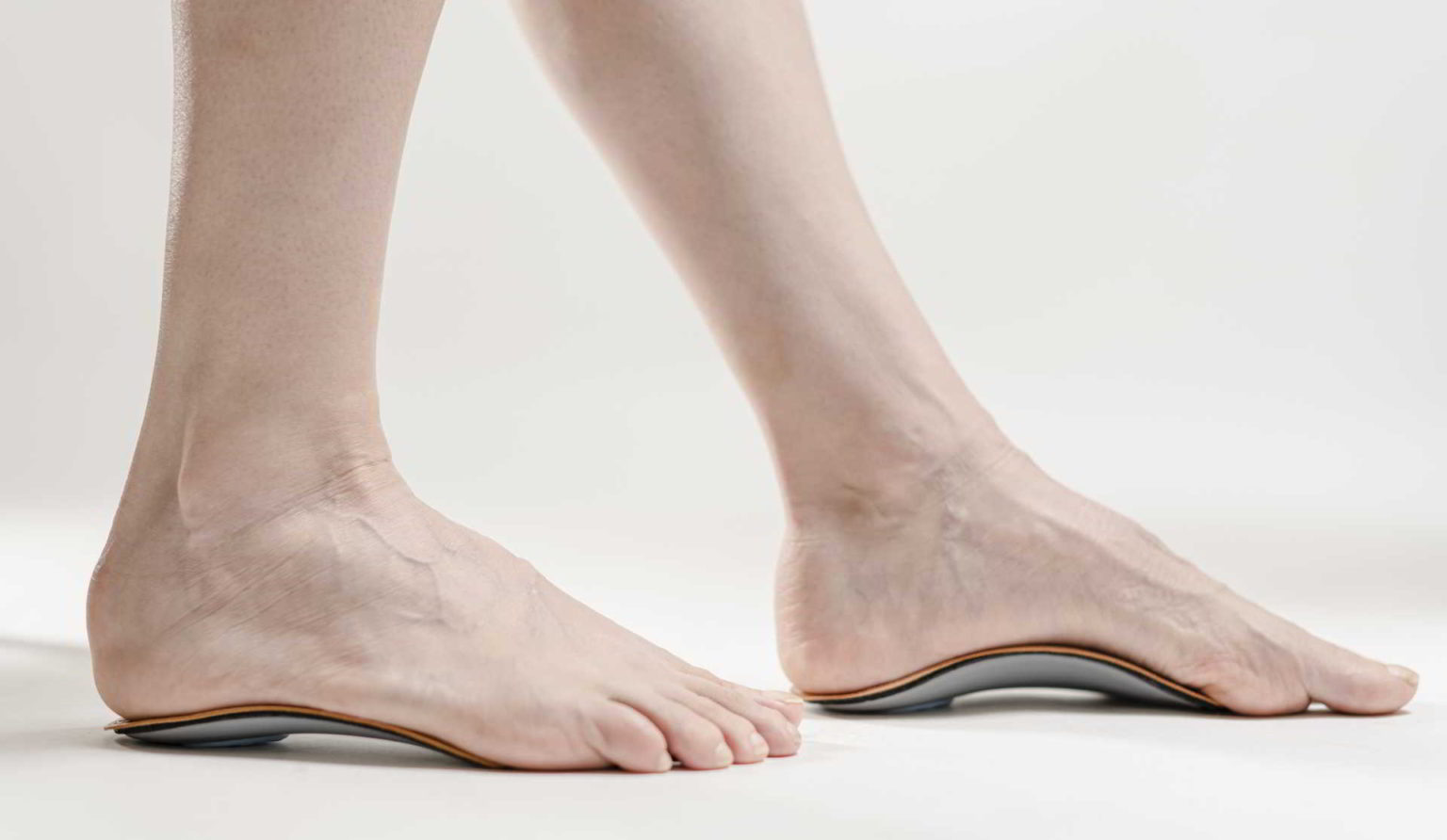 Bunion Revision Surgery Miami - Dr. Ray Lopez DPM