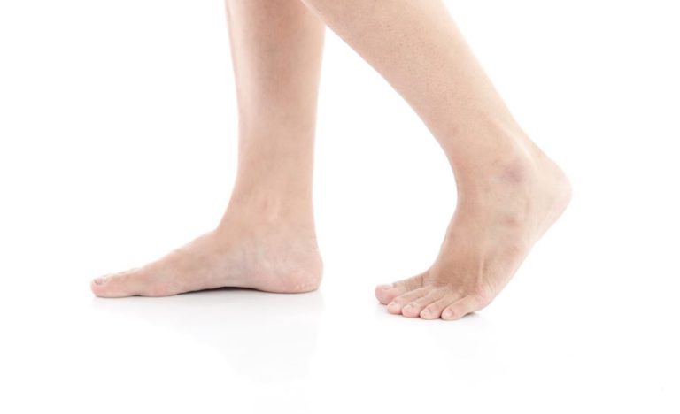 Difference Between Flat Feet and Normal Feet