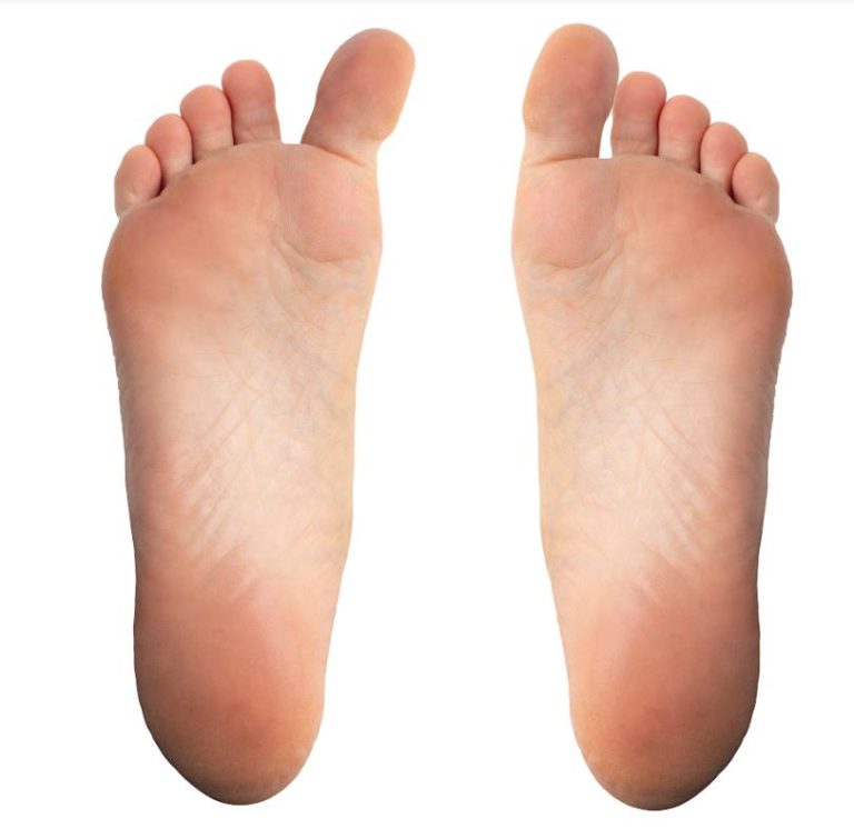 Toe Not Straight After Bunion Surgery