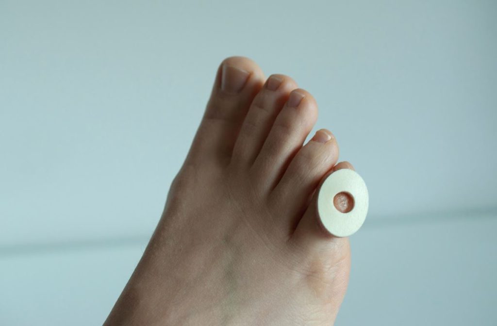 Corn Protectors Foot: The Best Foot Corn Protectors for Maximum Comfort