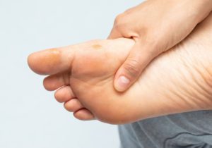 What is a Seed Corn on a Foot? Understanding the Causes and Symptoms of ...