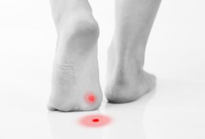 Inside of a Corn on Foot: Understanding the Anatomy of a Corn and How ...