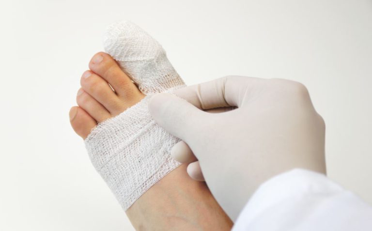 Laser Corn Removal Surgery: Starting from $1000