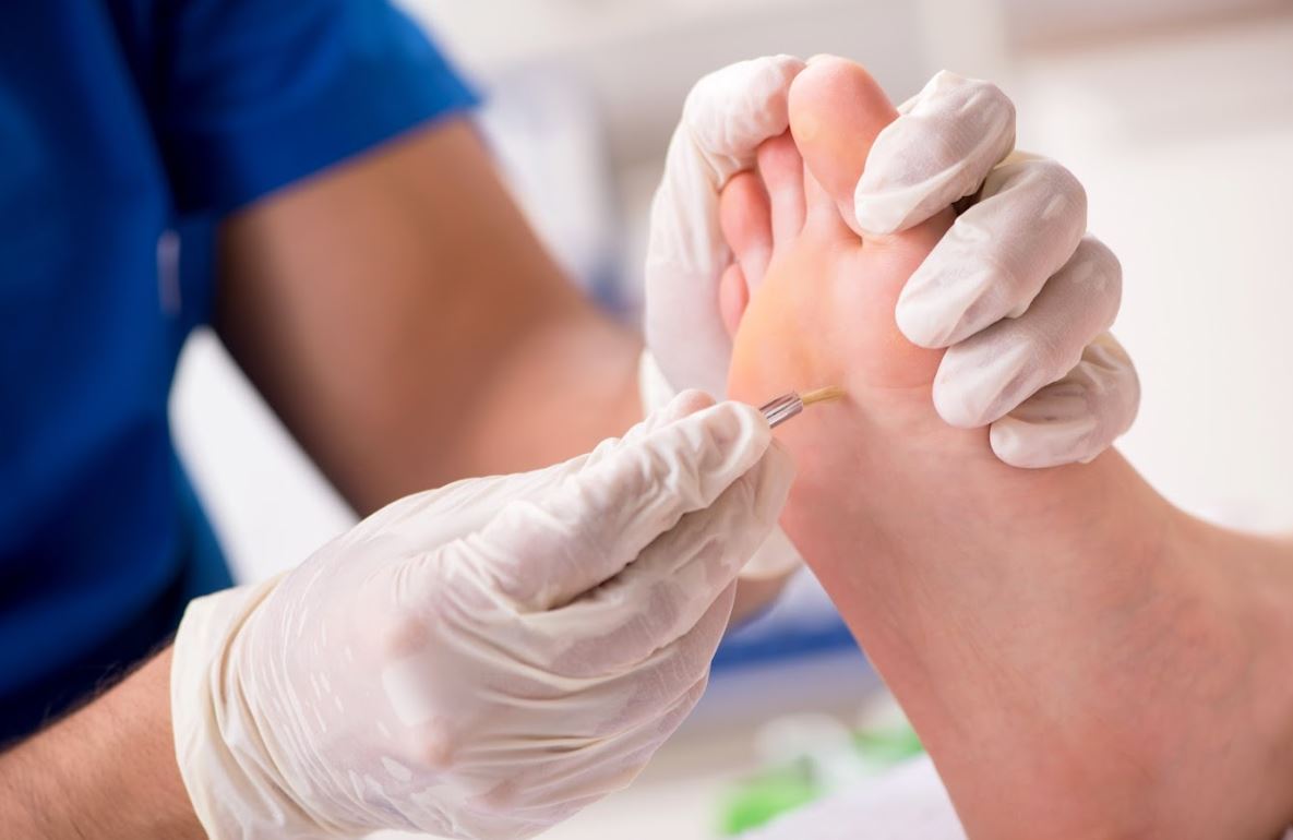 How to Get Rid of Hard Corn on Right Pinky Toe?