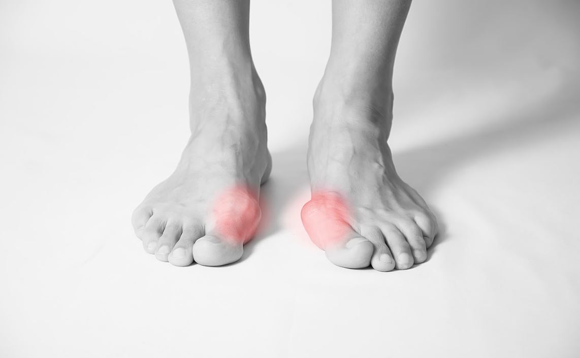 What Are Heloma Durum Causes?