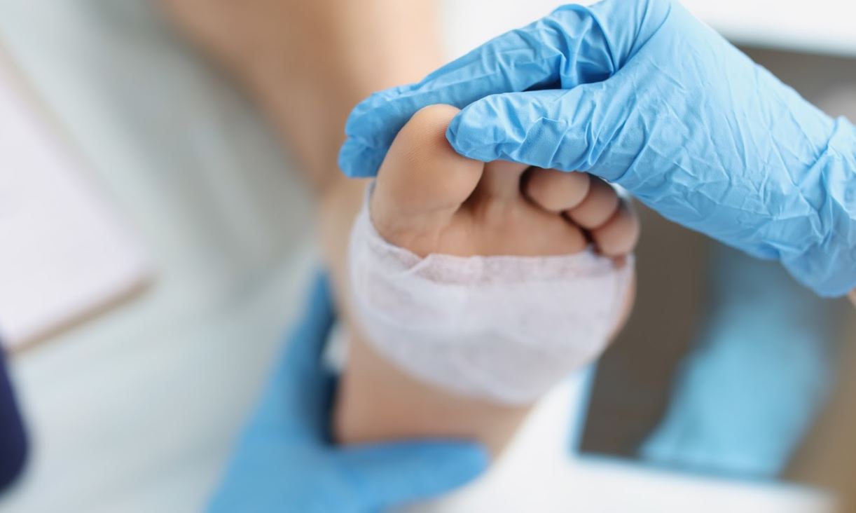 Corn Surgery Recovery Time