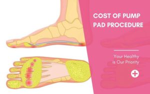 Pump Pad Procedure at Luxe Foot Surgery | Starting from $500