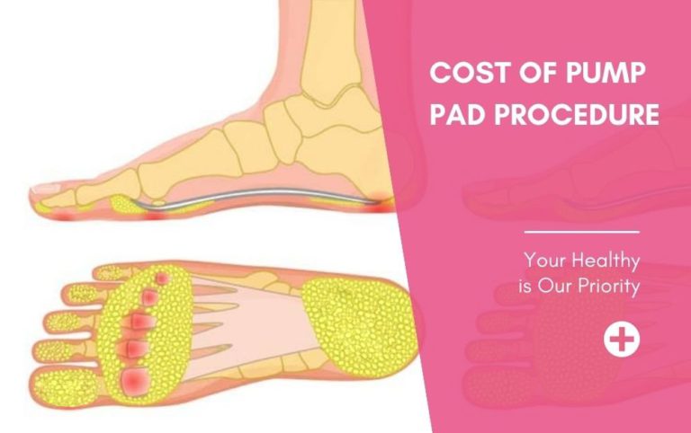 Pump Pad Procedure at Luxe Foot Surgery | Starting from $500