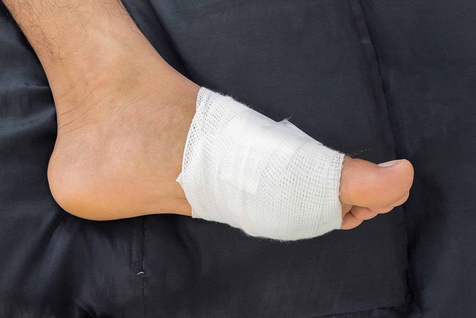 Bunion Recovery Week-By-Week Process: A Detailed Guide