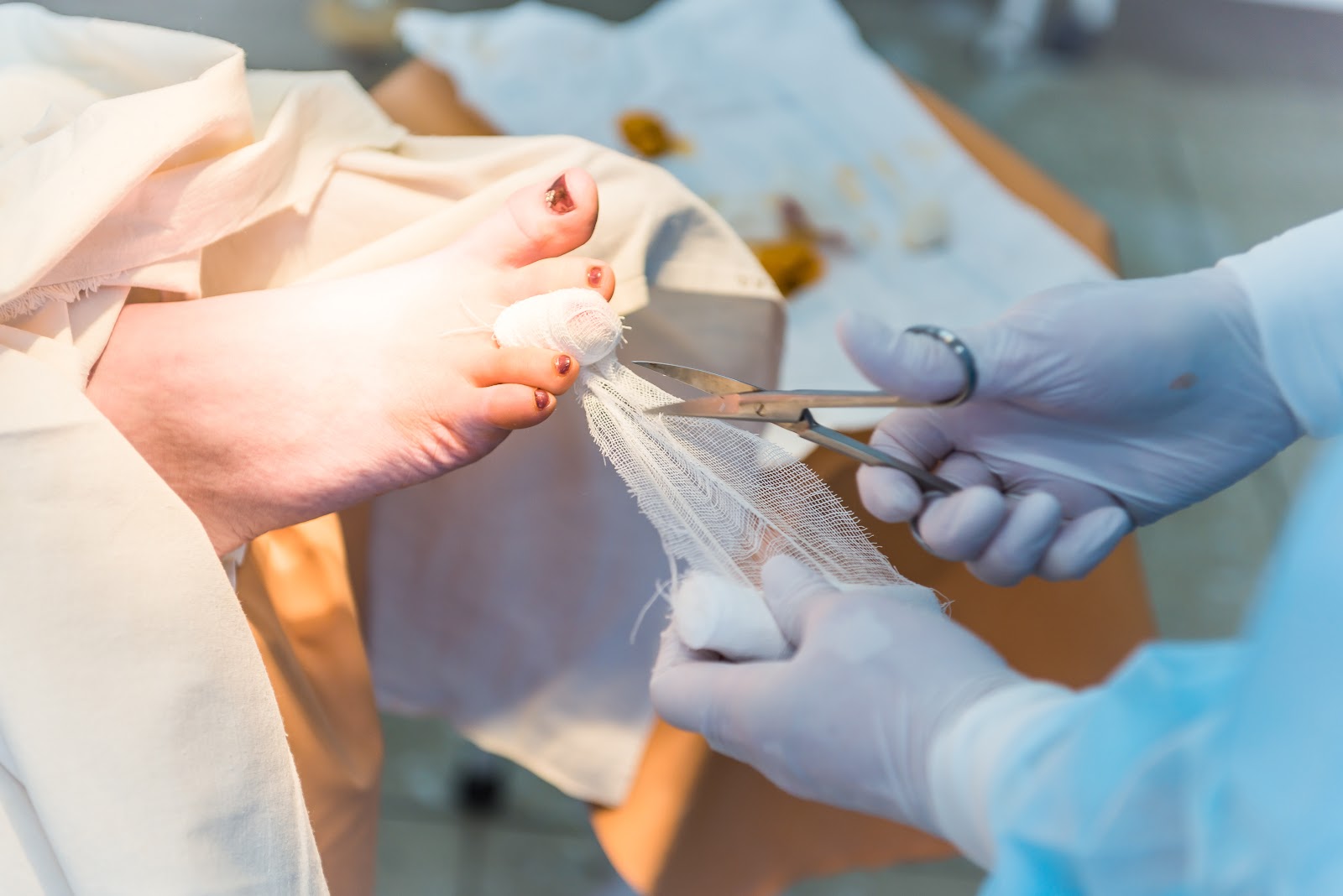 Floppy Toe After Hammertoe Surgery: Causes & Solutions