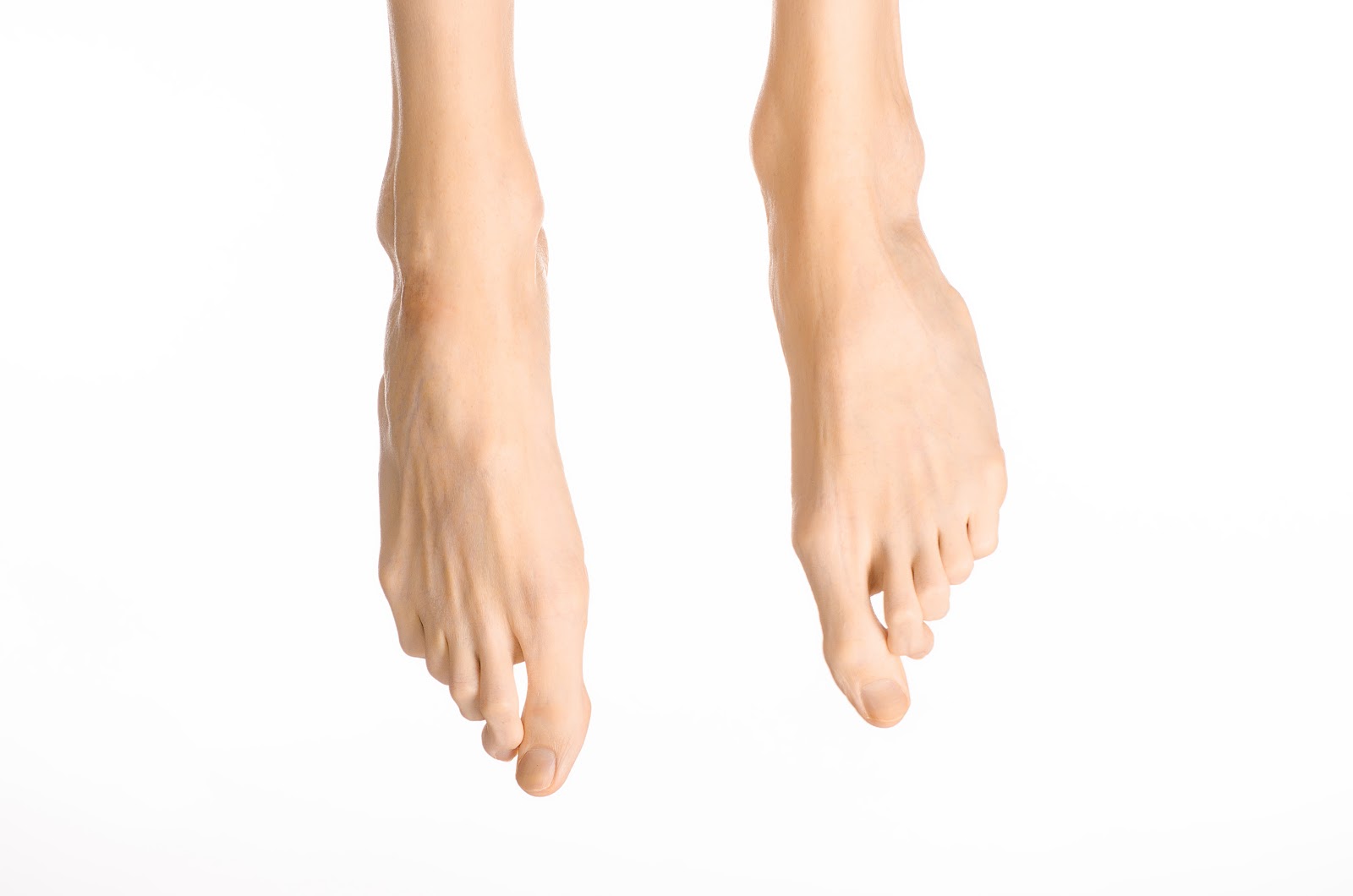 Cost of Toe Shortening for 6 Toes: Detailed Cost Breakdown